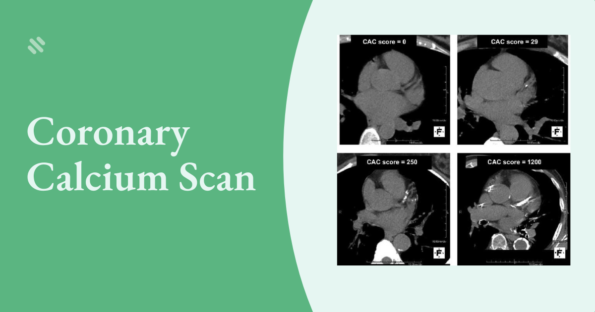 Coronary Calcium Scan | Instalab